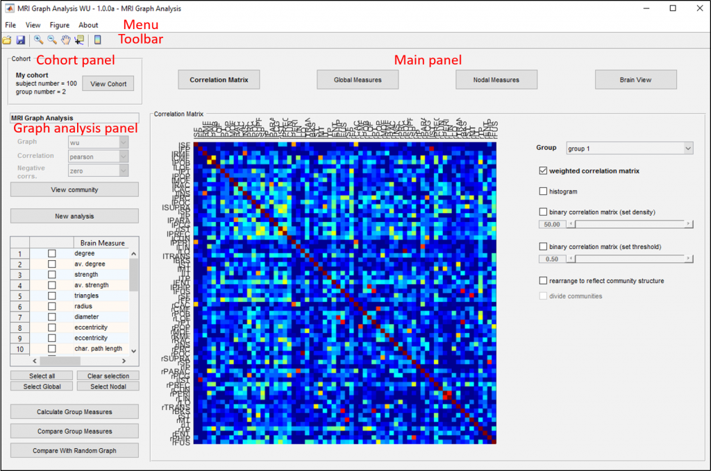 MRI Graph Analysis WU - BRAPH